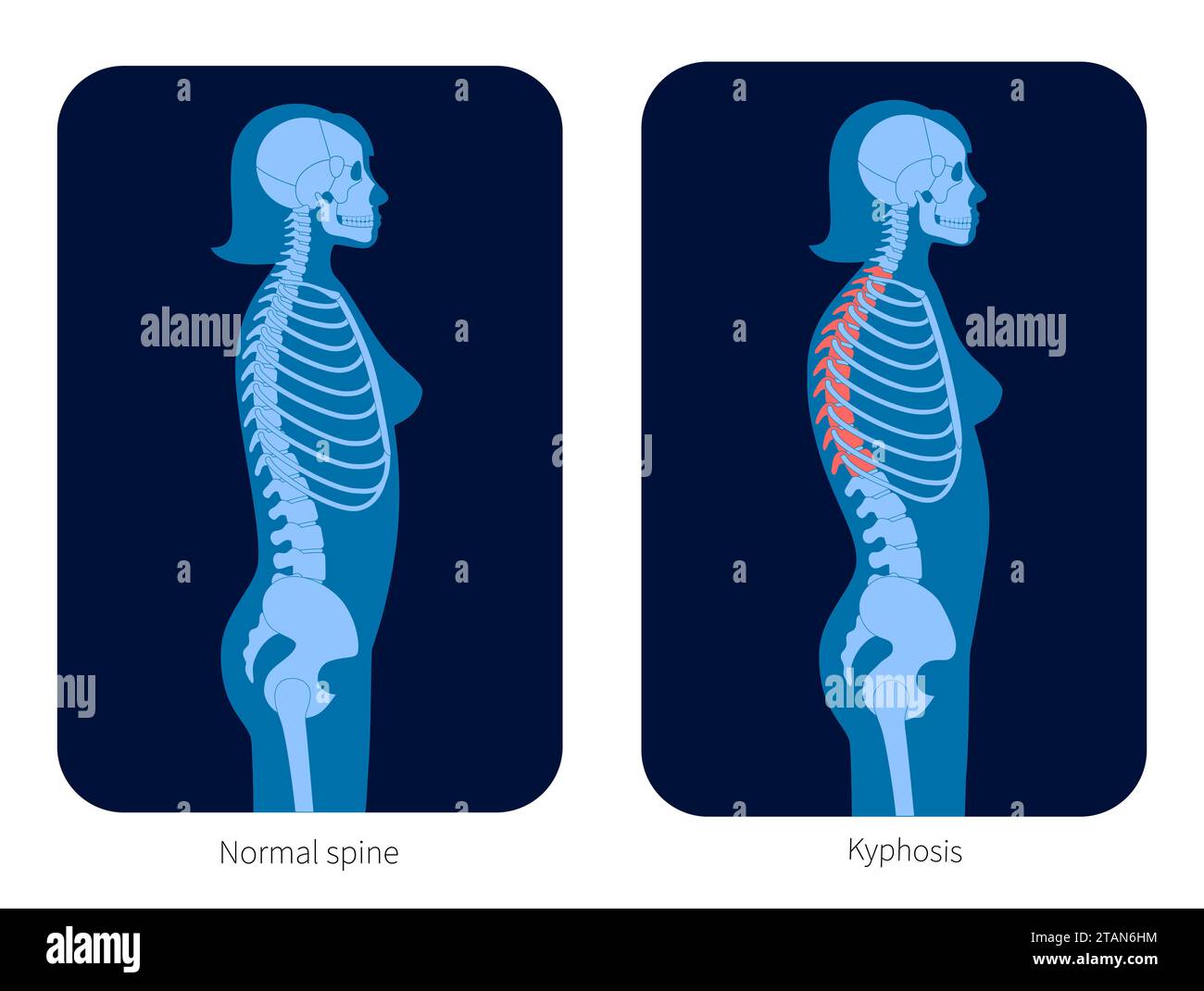 Femme l'examen médical scoliose Banque d'images détourées - Alamy