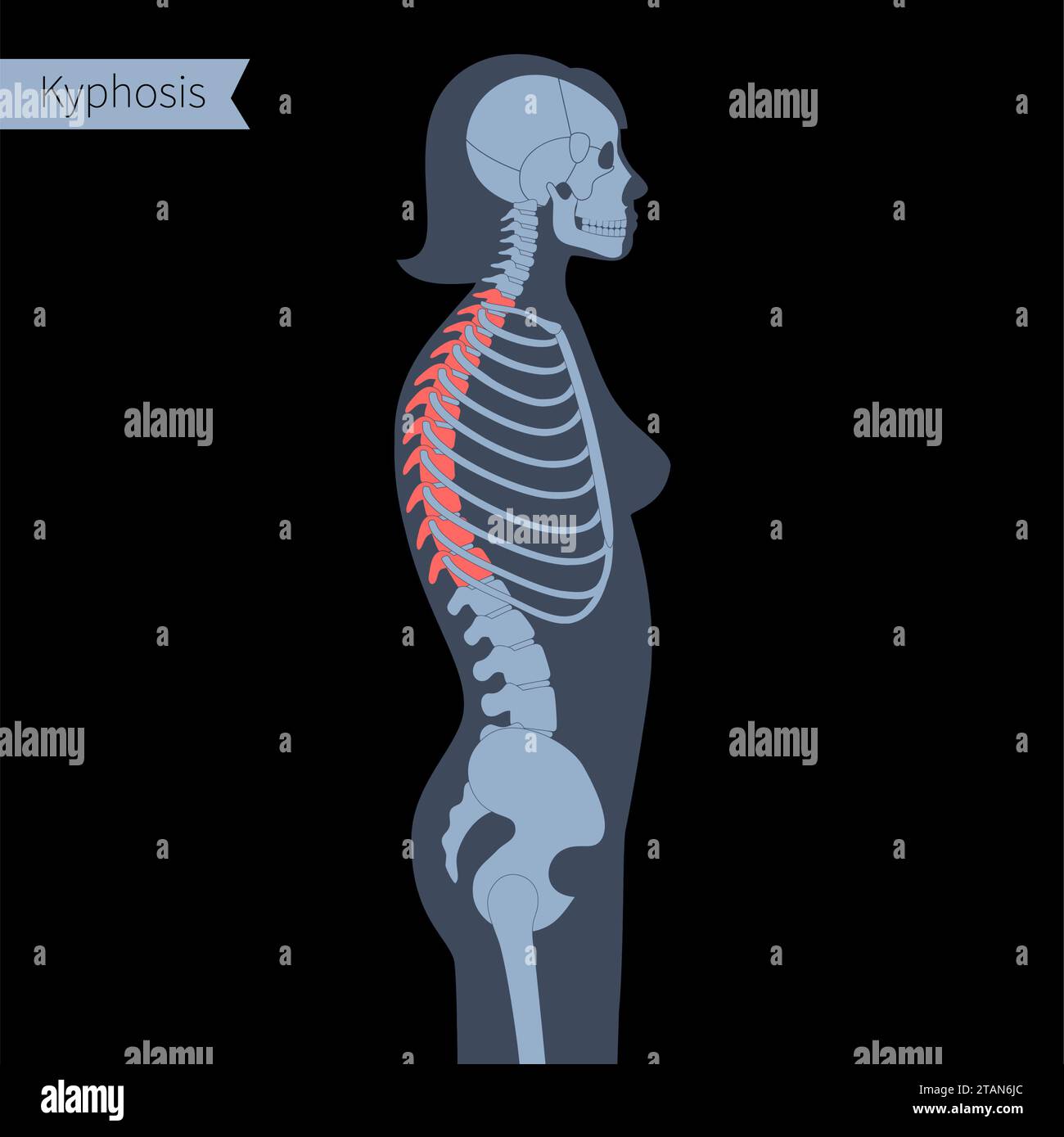 Columna vertebral humana y dolor de espalda Banque de photographies et ...