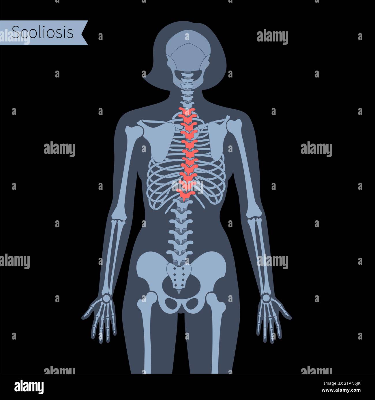 Femme l'examen médical scoliose Banque de photographies et d’images à ...