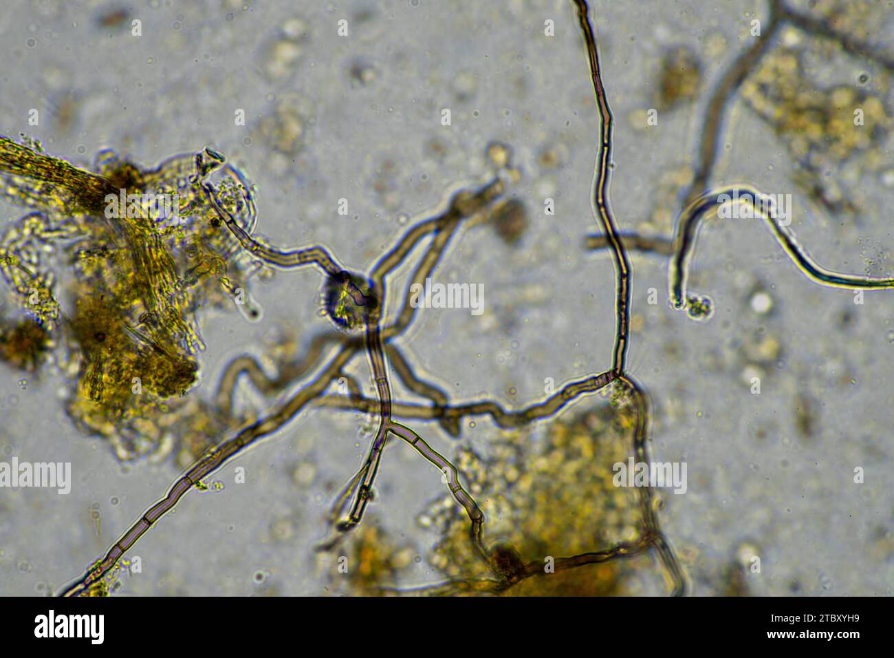 Fungus microscope Banque de photographies et d’images à haute ...