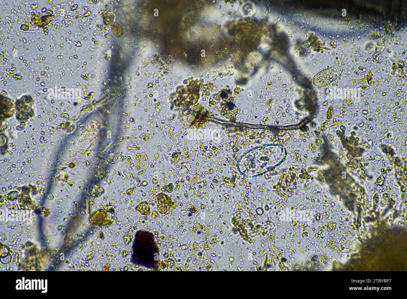 Moisissures au microscope Banque de photographies et d’images à haute ...