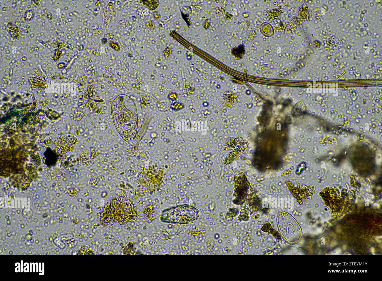 Moisissures au microscope Banque de photographies et d’images à haute ...