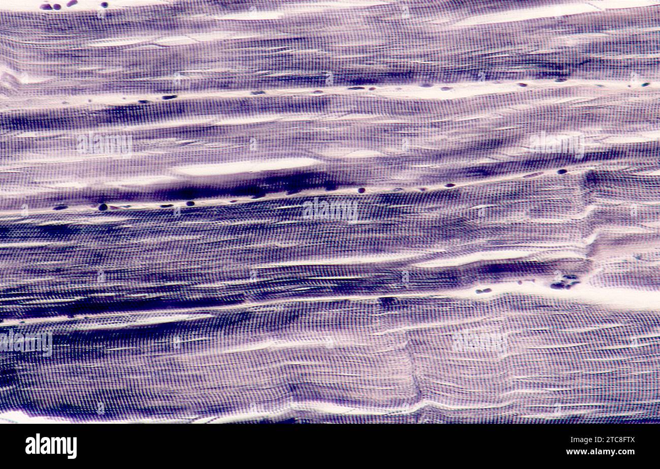 Tissu musculaire Banque de photographies et d’images à haute résolution ...