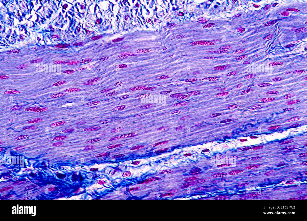 Tissu musculaire Banque de photographies et d’images à haute résolution ...