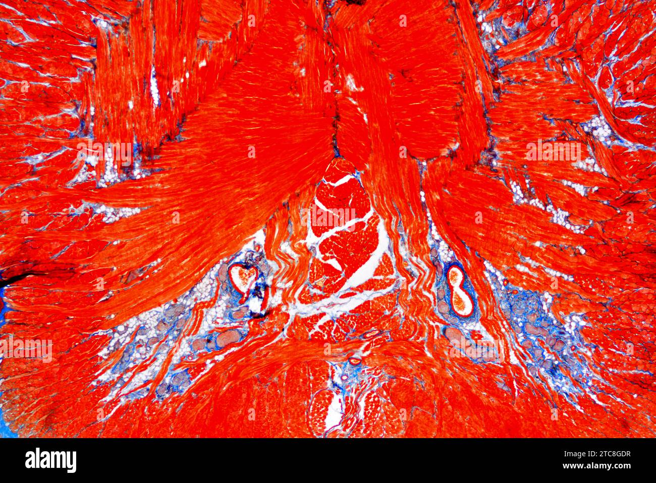 Coupe transversale de la langue montrant le muscle squelettique, le ...