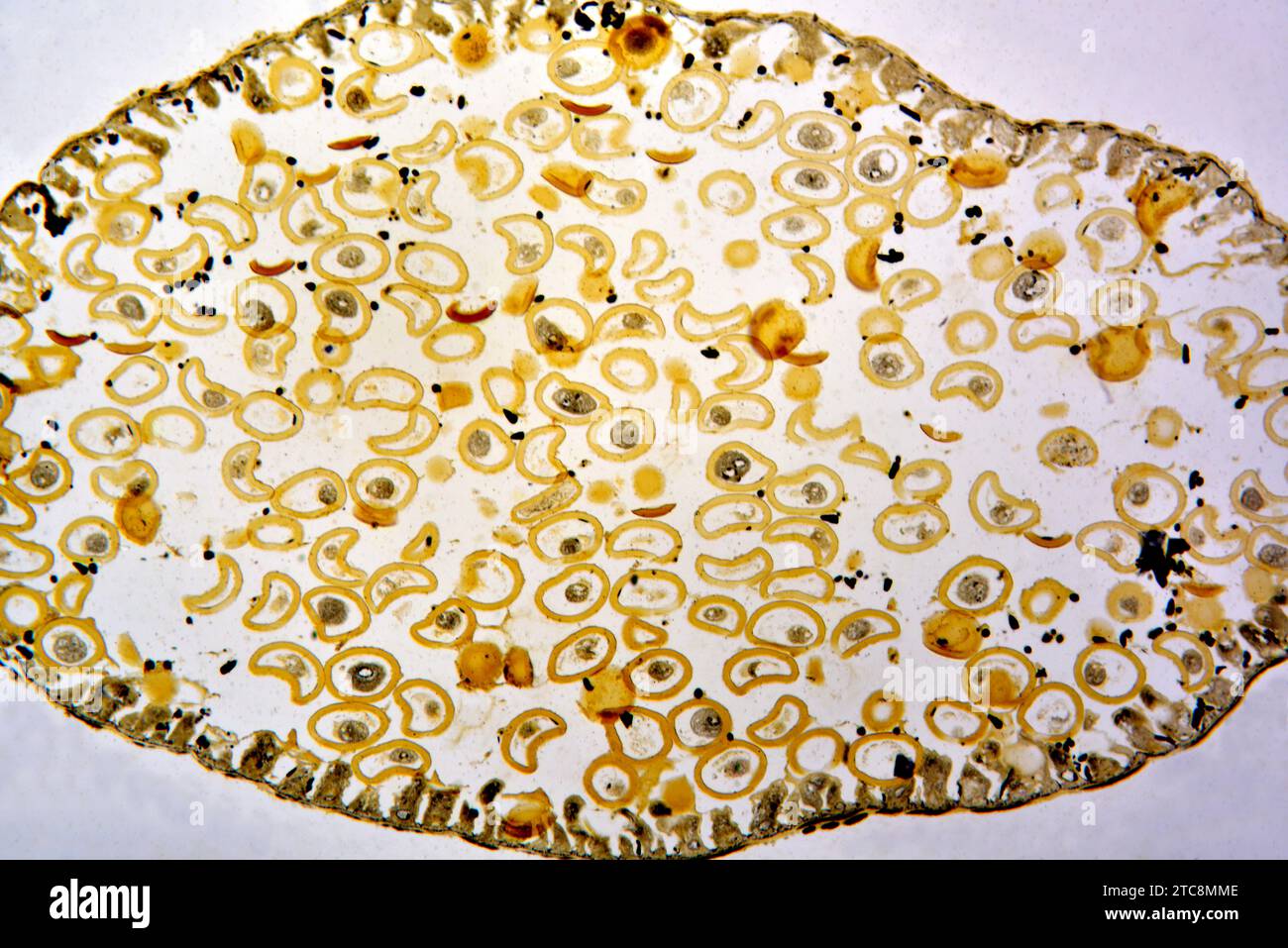 Roundworm microscope Banque de photographies et d’images à haute ...