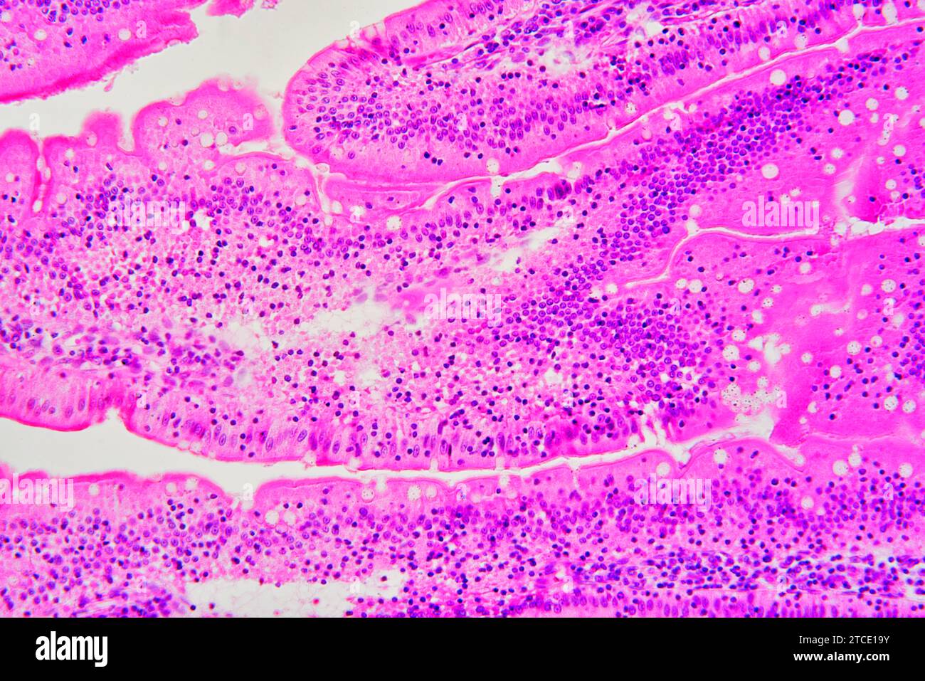 Coupe transversale intestin grèle Banque de photographies et d’images à ...