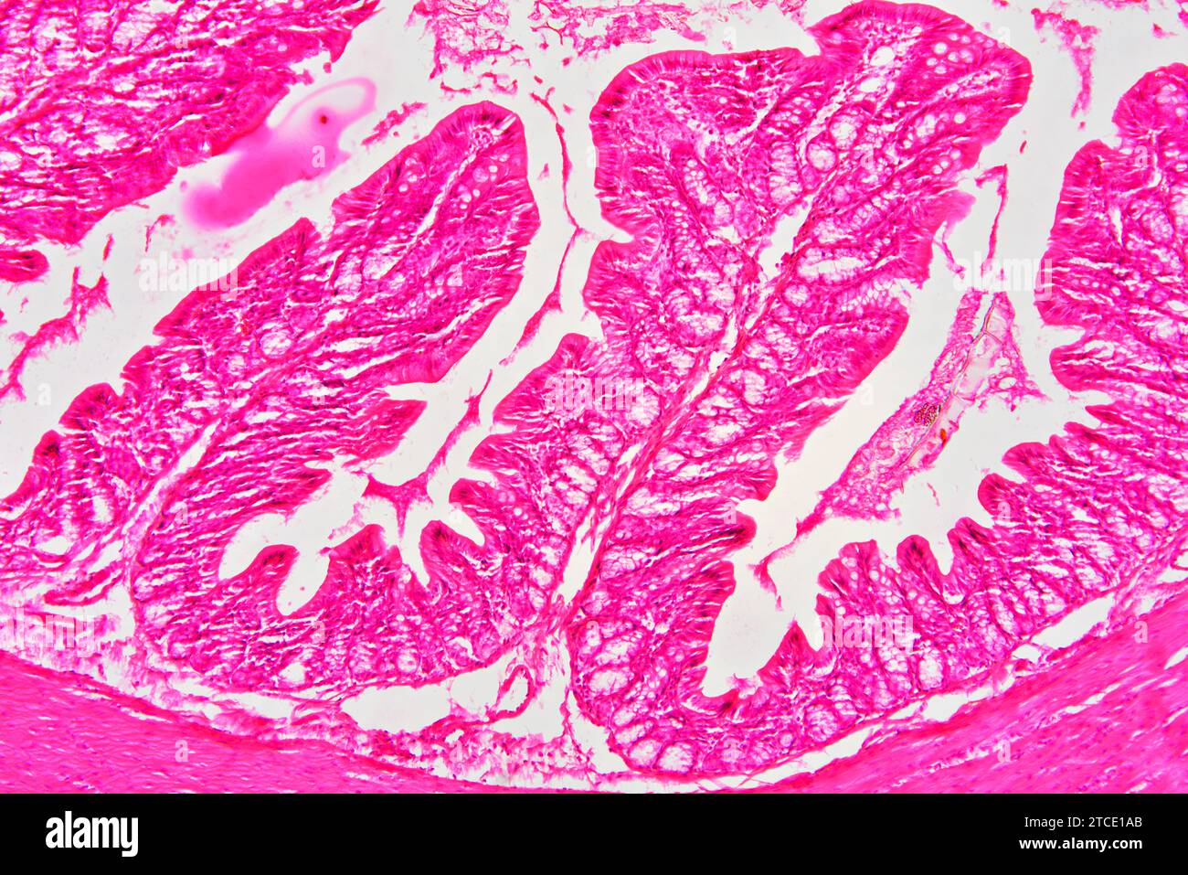 Rectum epithelium Banque de photographies et d’images à haute ...