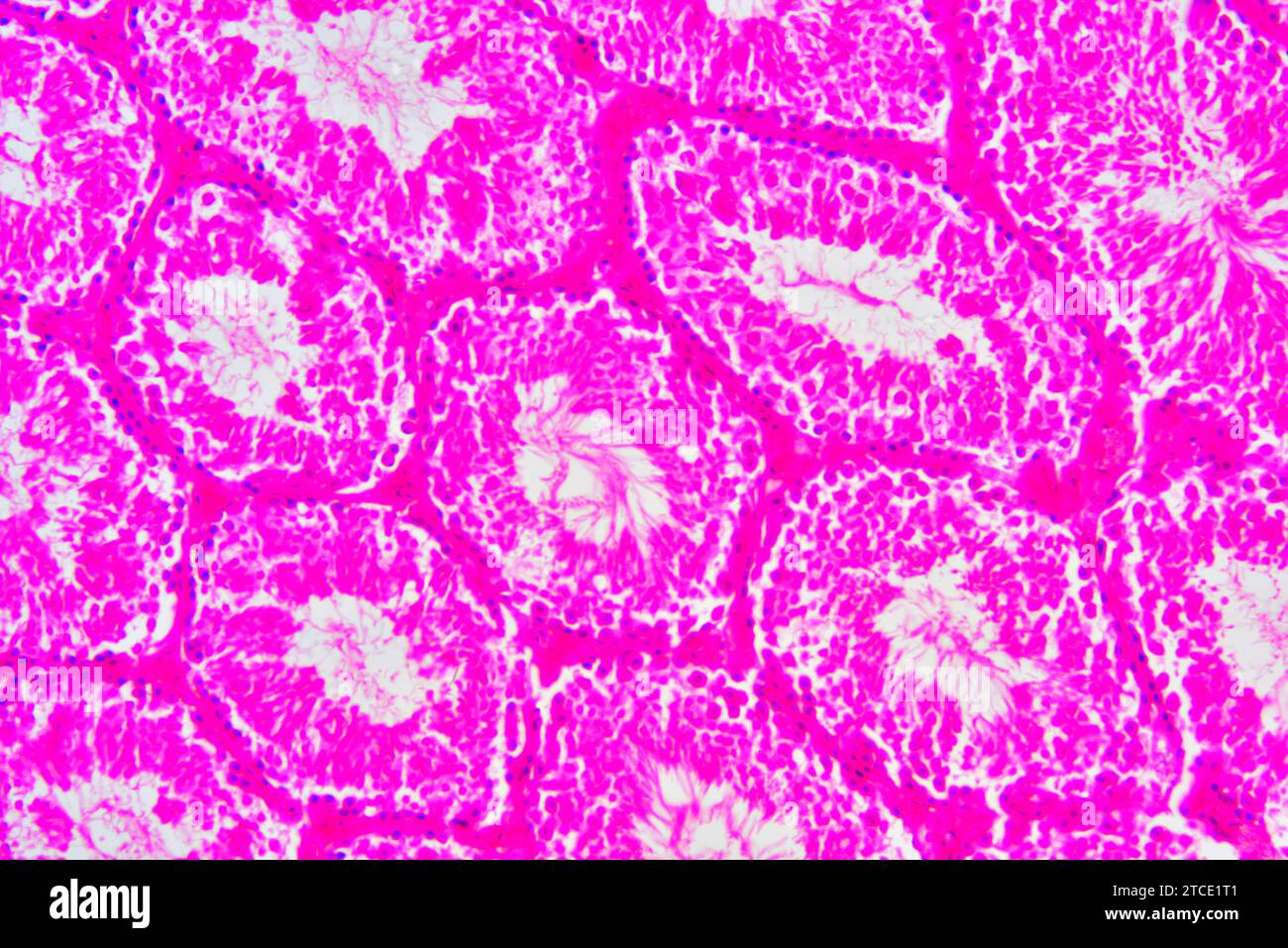 Testicule humain ou section de testicule montrant des tubules ...