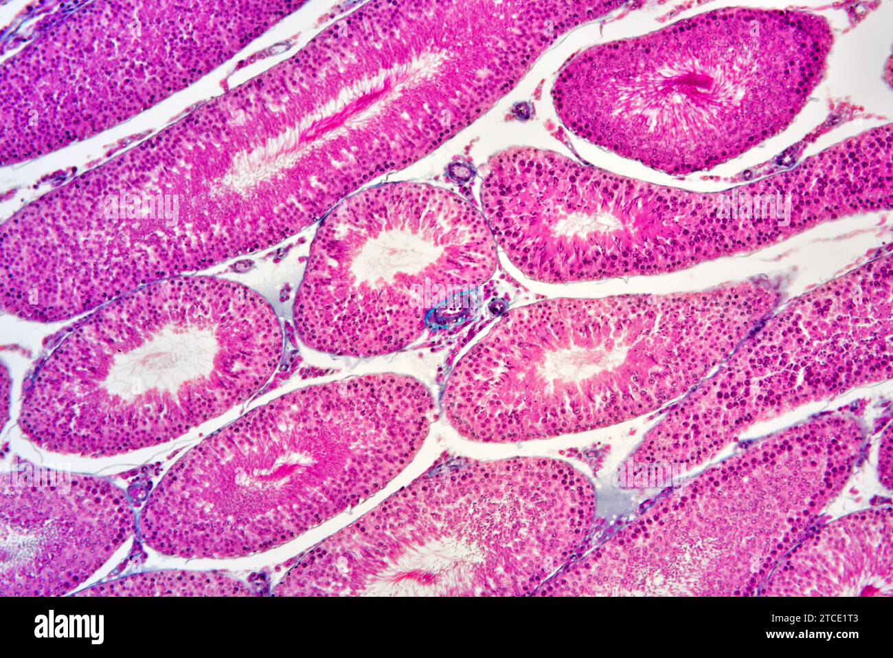 Testicule humain ou coupe de testicule montrant des tubules séminifères ...