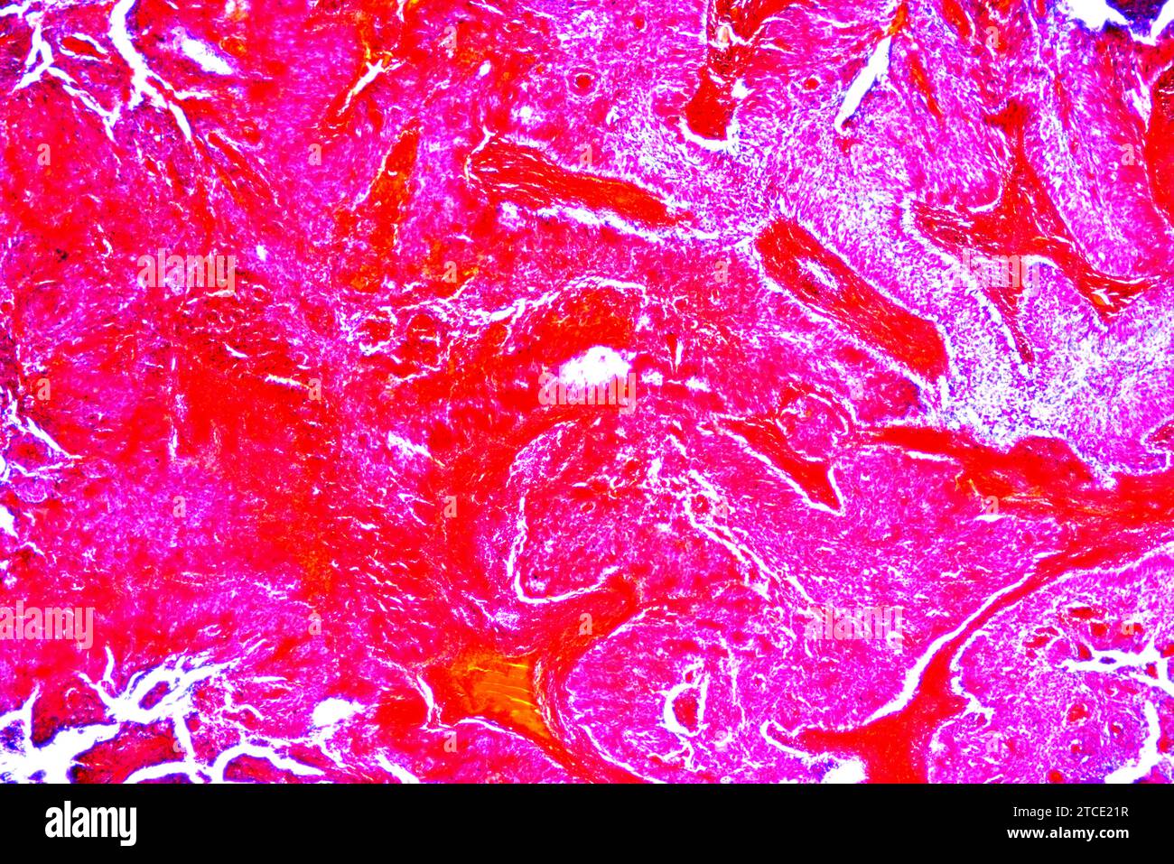 Uterus histology Banque de photographies et d’images à haute résolution ...