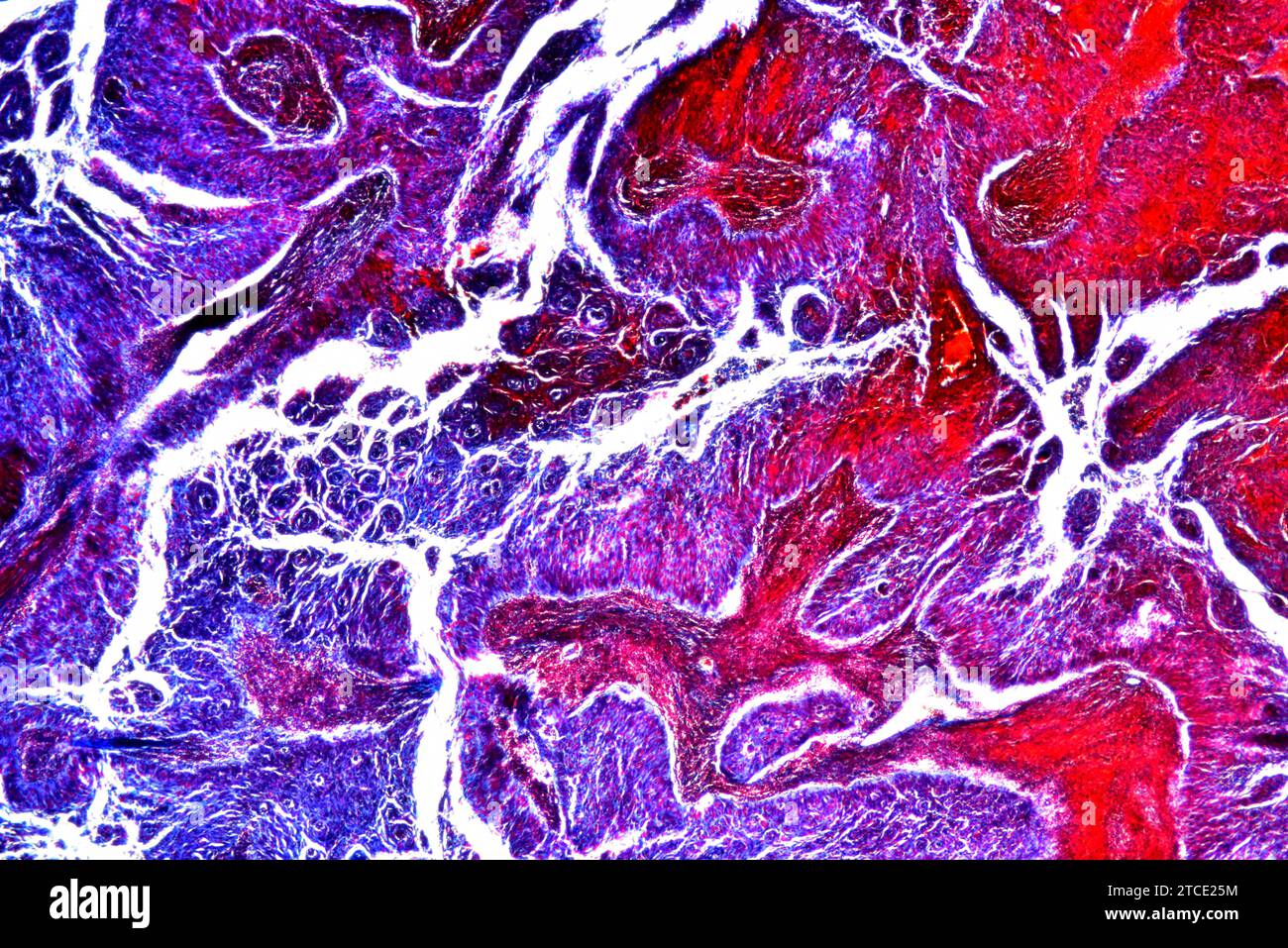 Uterus histology Banque de photographies et d’images à haute résolution ...