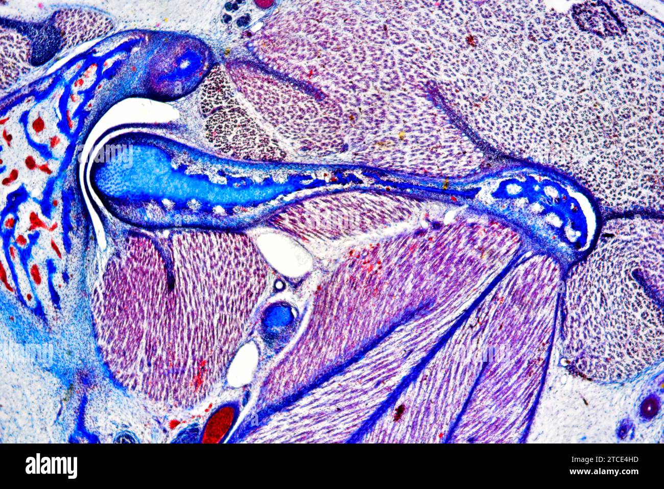Ear microscope Banque de photographies et d’images à haute résolution ...