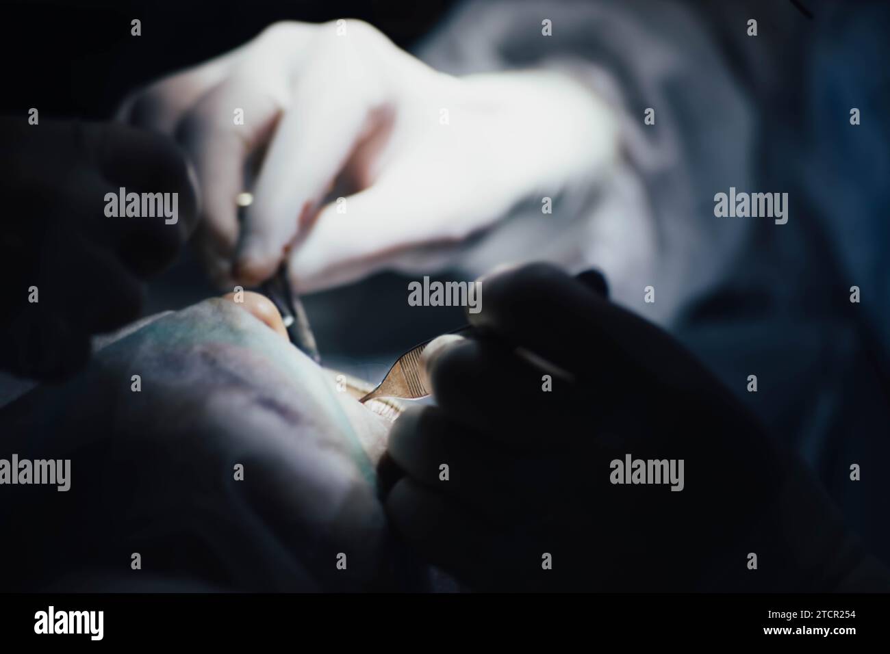 Instrument chirurgical Banque de photographies et d’images à haute ...