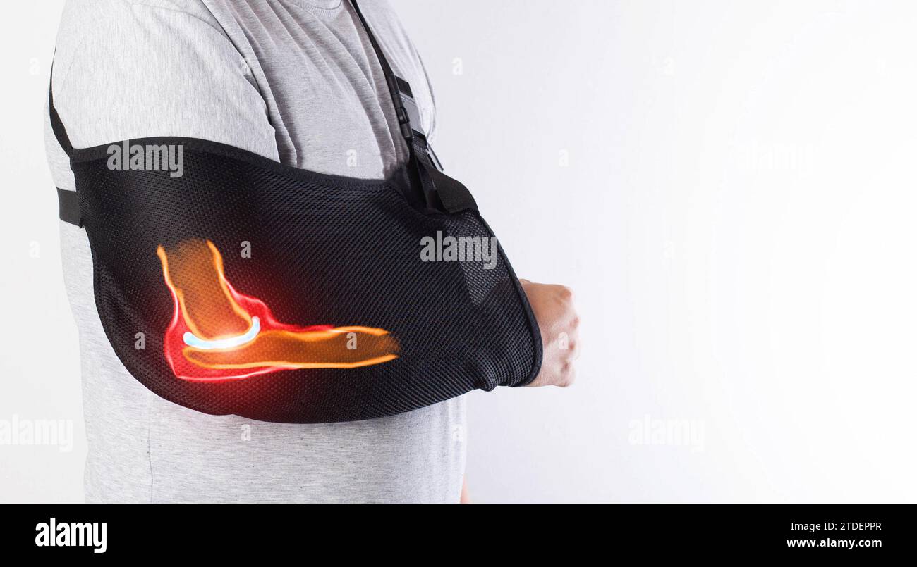 Un bras d'homme dans un bandage noir pour l'immobilisation de l ...