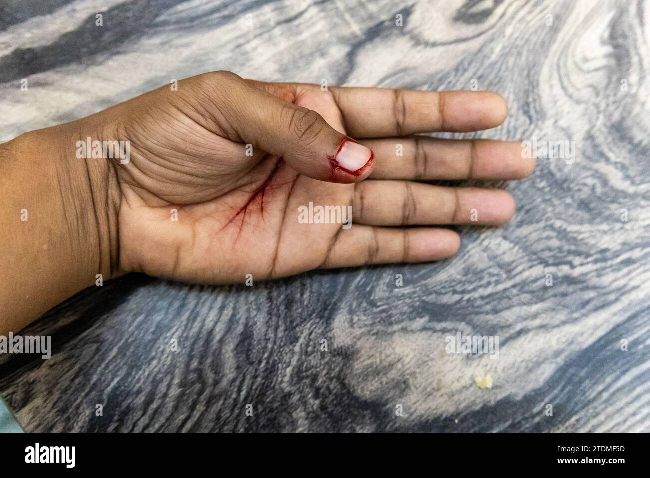 Femme avec du sang sur sa main Banque de photographies et d’images à ...