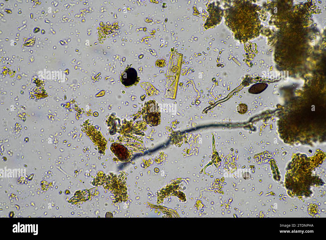 micro-organisme du sol sous le microscope recyclage des nutriments dans ...