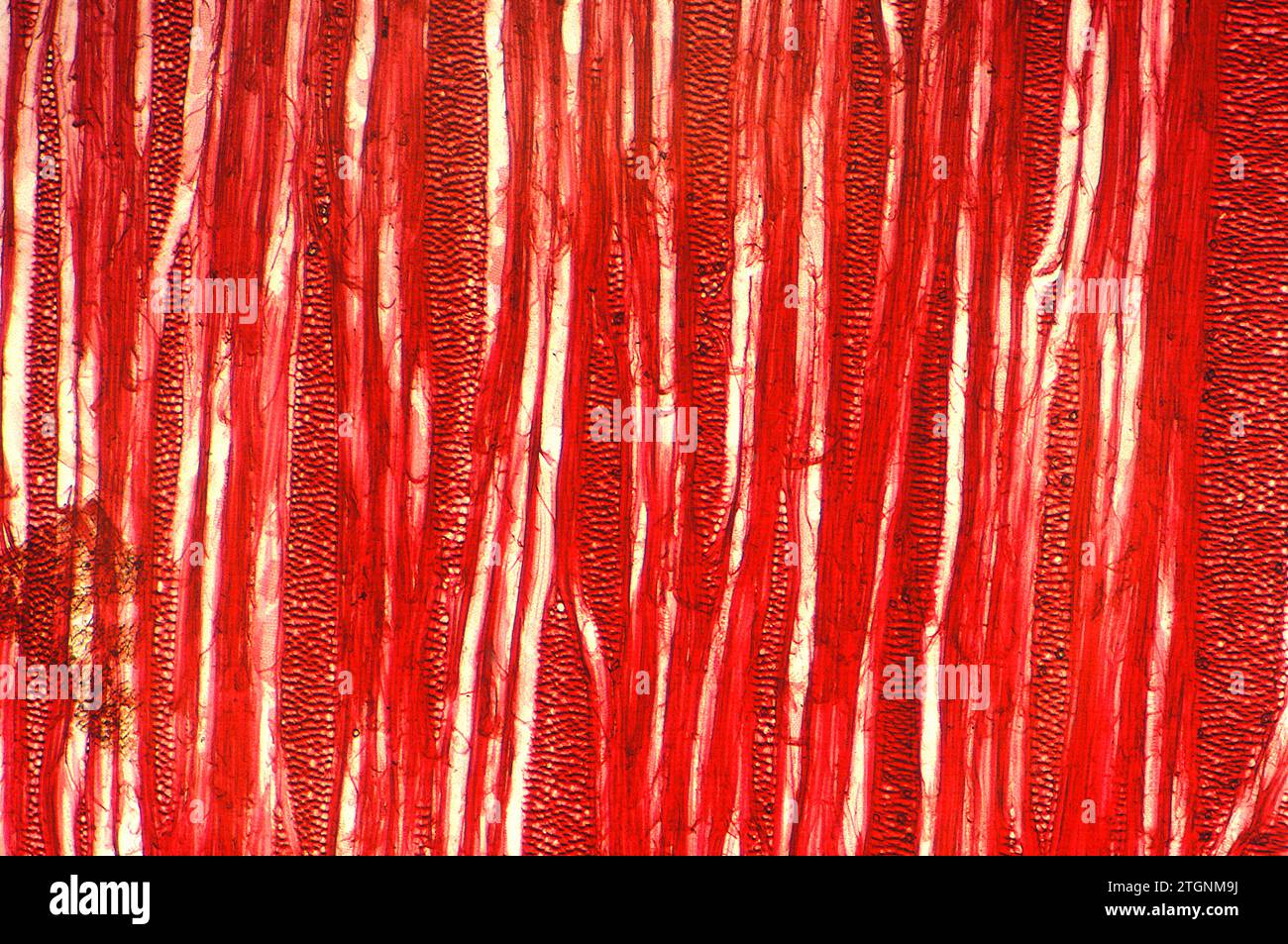 Trachéides de vaisseaux Banque de photographies et d’images à haute ...