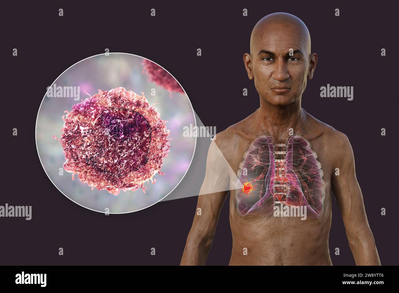 Homme 3d anatomie Banque de photographies et d’images à haute ...