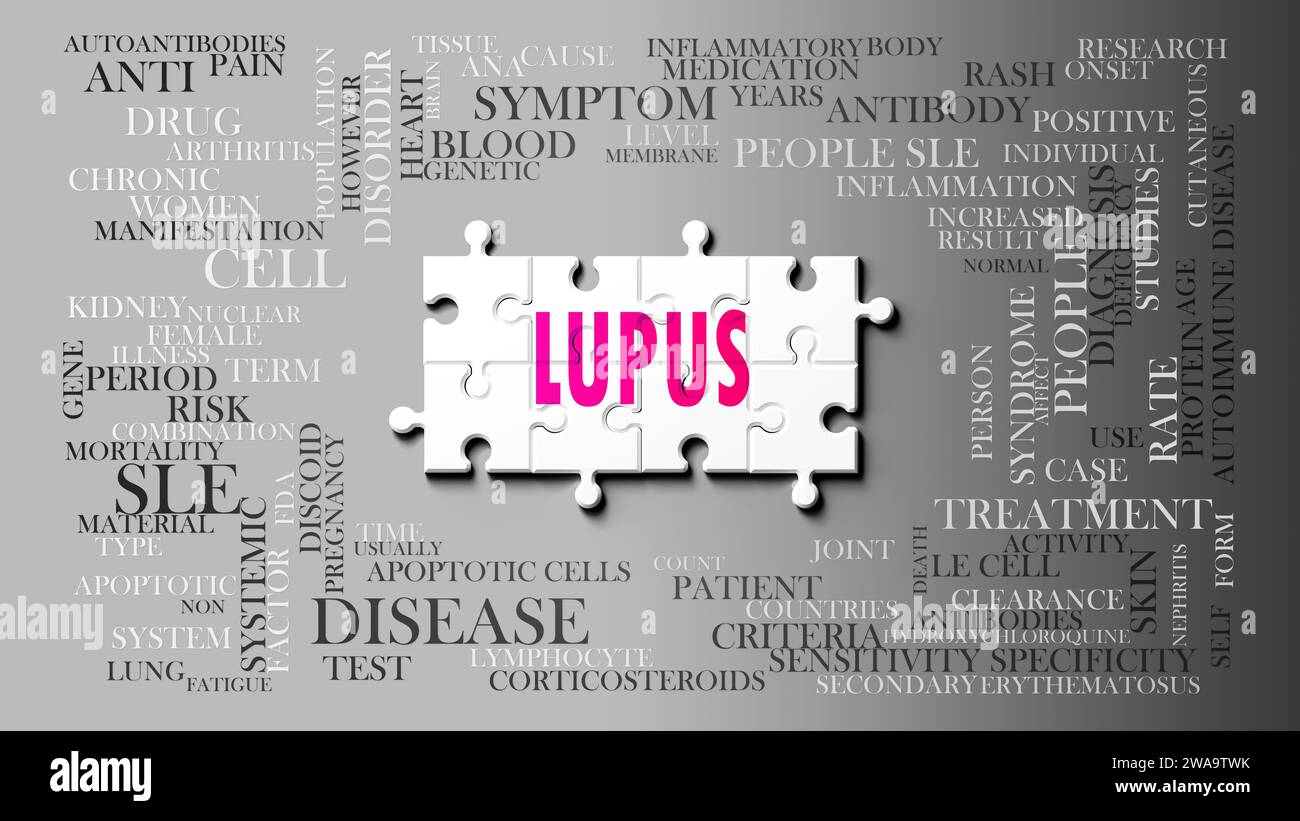 Lupus - un sujet complexe, lié à de nombreux concepts. Représenté comme ...