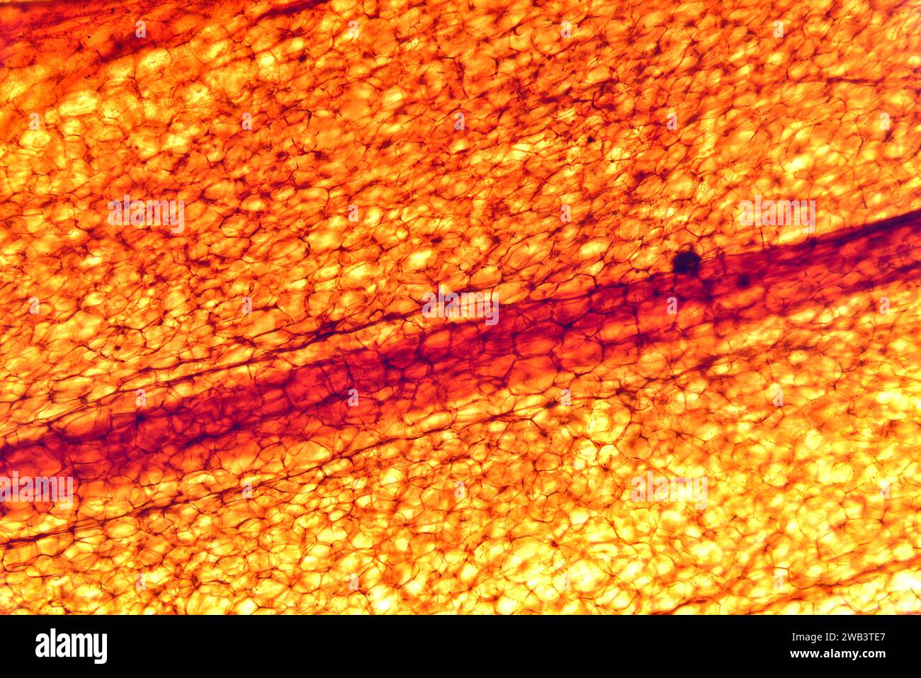 Squamous epithelium Banque de photographies et d’images à haute ...