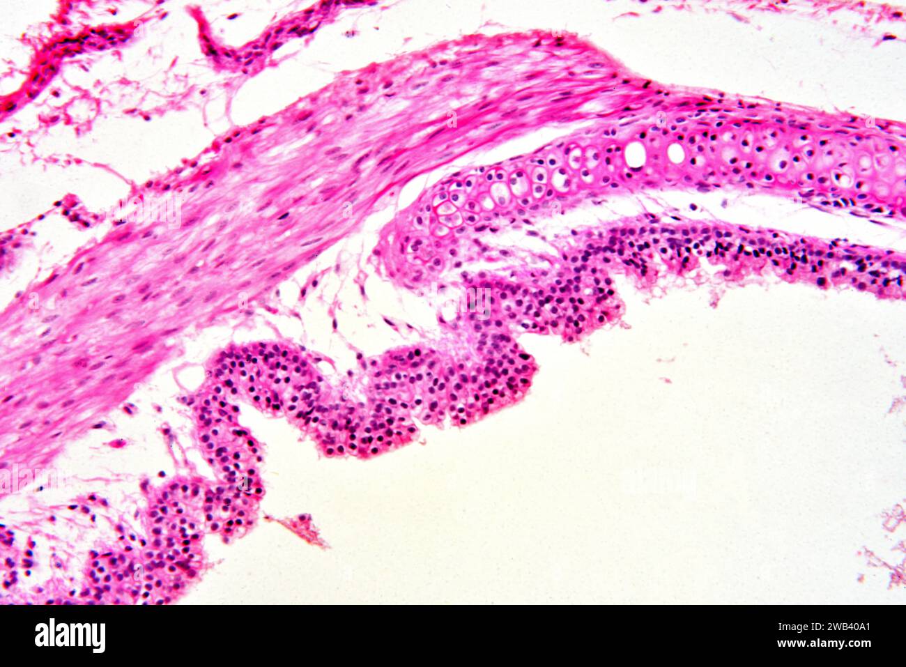 Trachée humaine montrant un cartilage hyaliné, des fibres musculaires ...