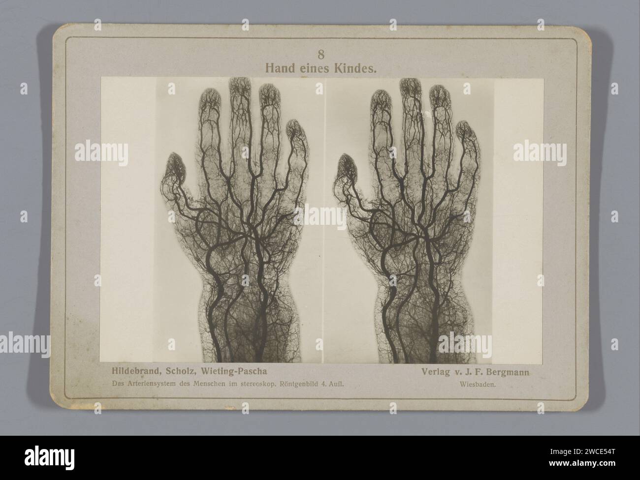 Childs circulatory system Banque de photographies et d’images à haute ...