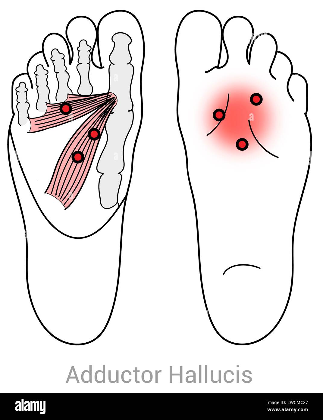 Adductor hallucis Banque de photographies et d’images à haute ...