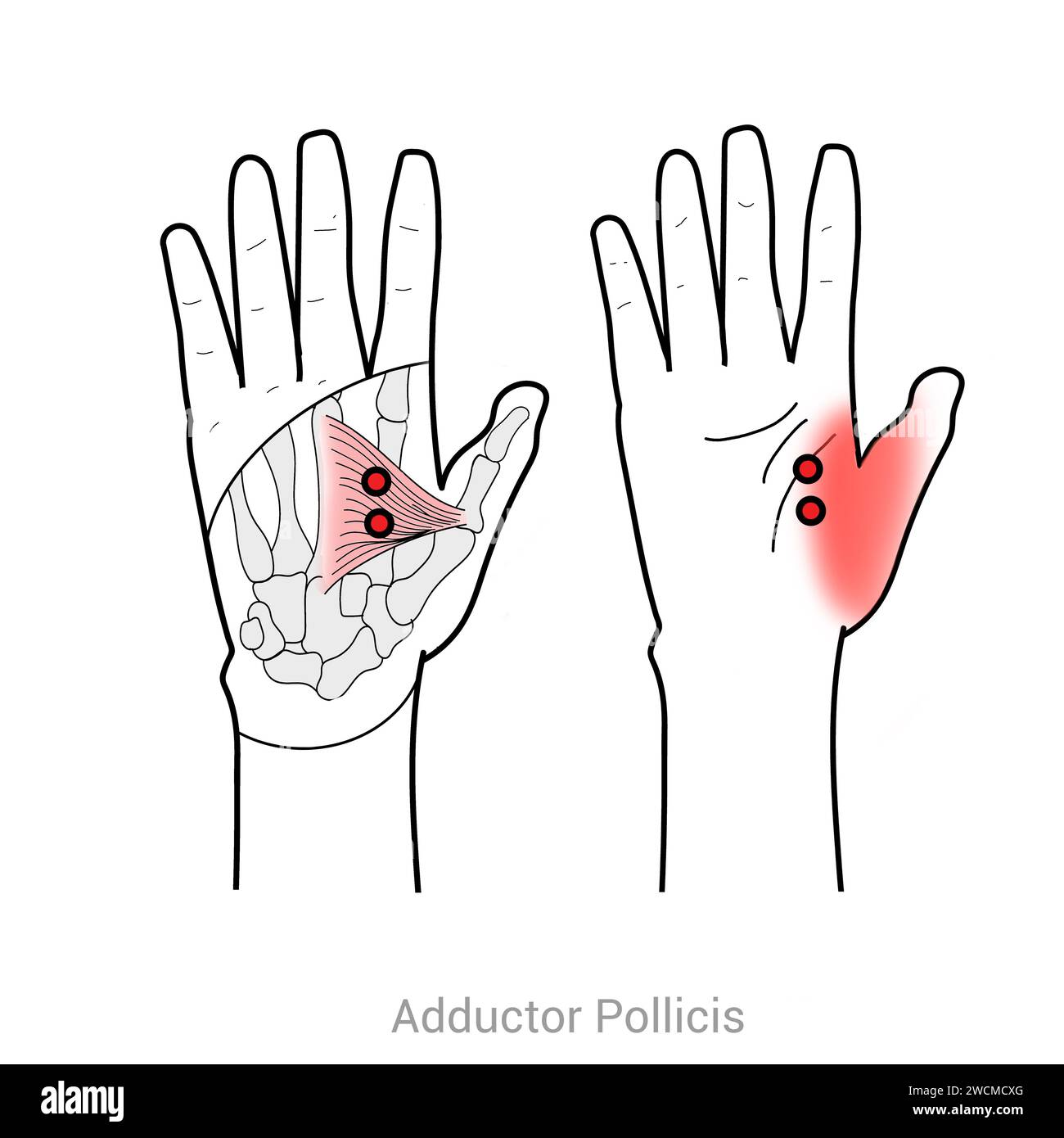 Muscle adducteur du pouce Banque de photographies et d’images à haute ...