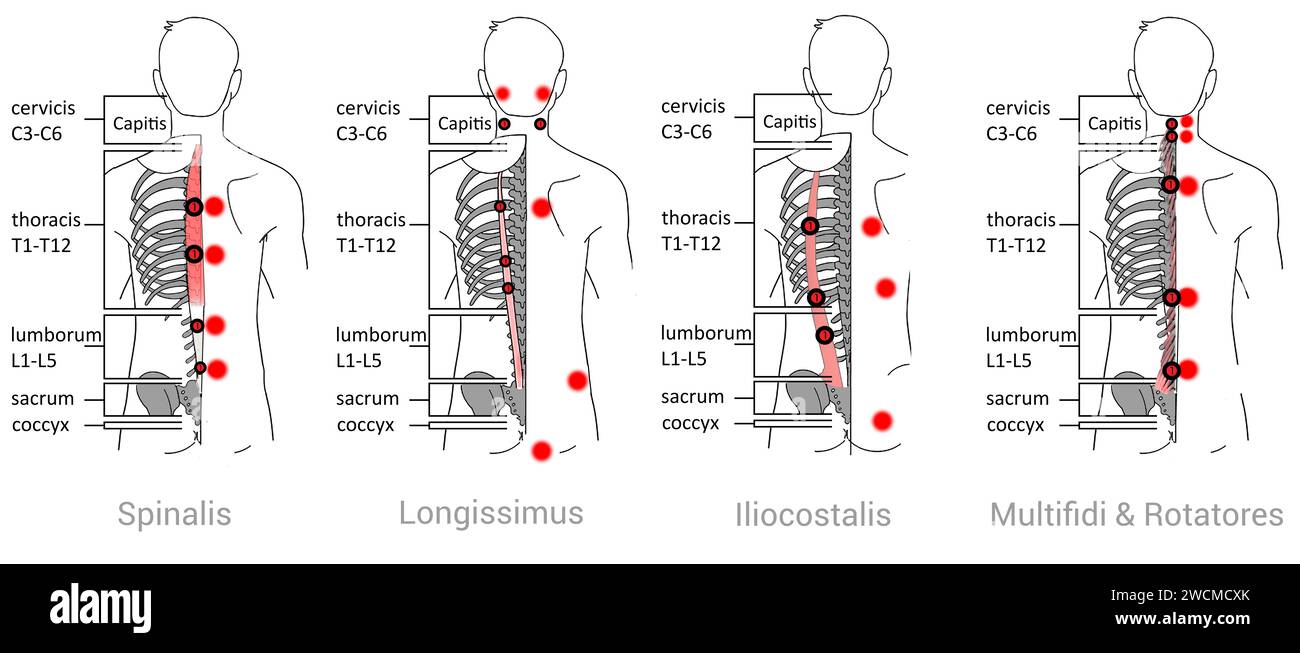 Anatomía del cerdo músculos profundos Banque de photographies et d ...