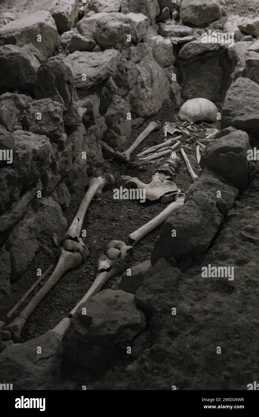 Cadavre humain Banque de photographies et d’images à haute résolution ...