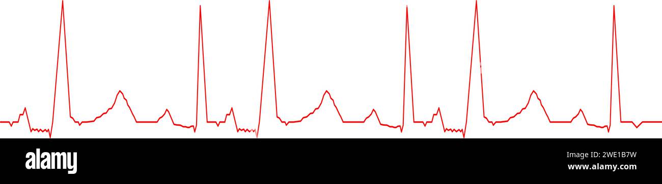 Diagramme de pulsation. Graphique ECG. Ligne rouge du rythme cardiaque ...