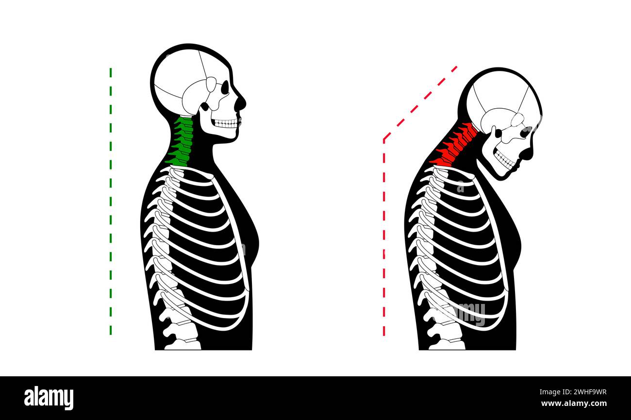 Cervical curve Banque d'images détourées - Alamy