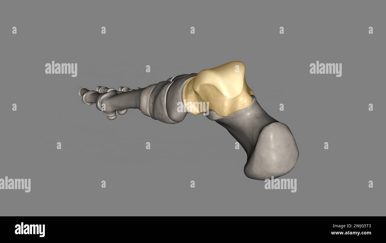 Fracture du talus cheville Banque de photographies et d’images à haute ...