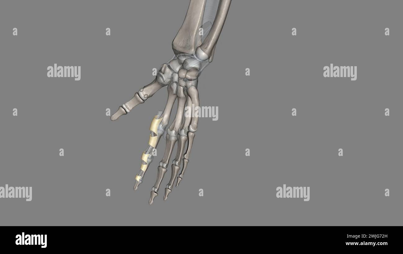 Le ligament annulaire est une structure complexe formée de la capsule ...