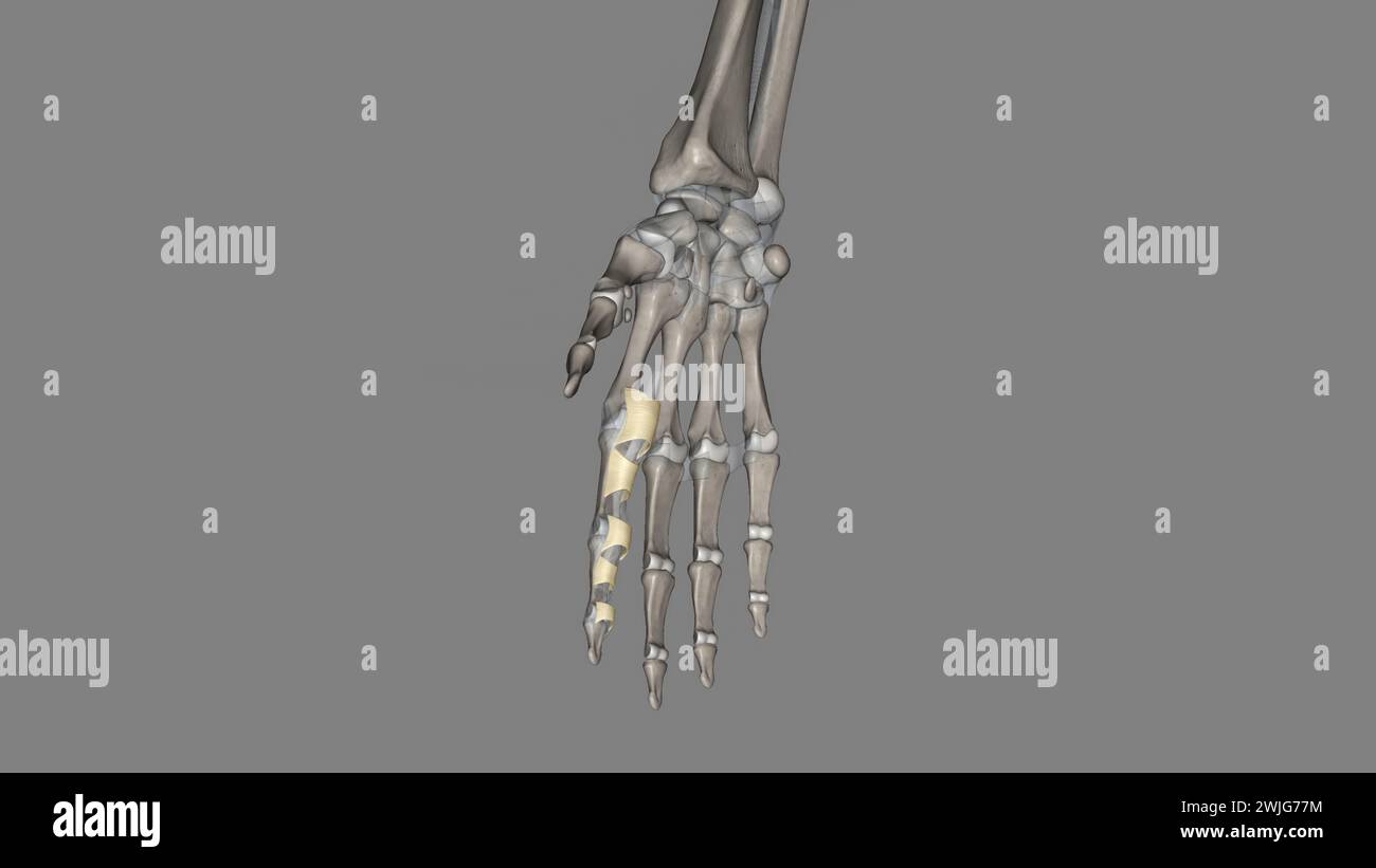 Le ligament annulaire est une structure complexe formée de la capsule ...