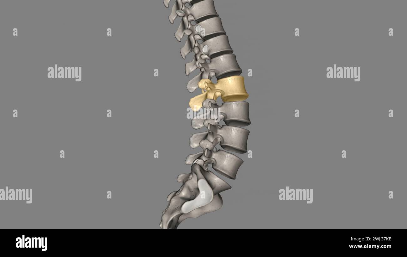 Courbure de la colonne vertébrale Banque de photographies et d’images à ...