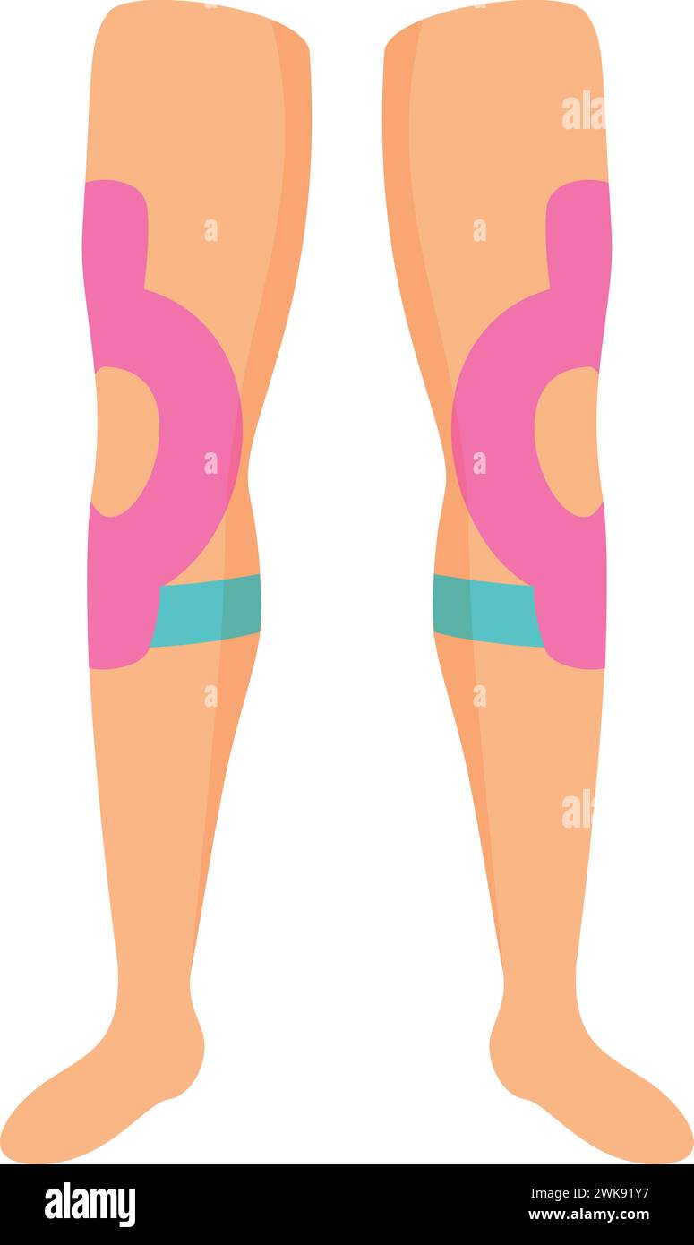 Kinesio tape genoux Banque d'images vectorielles - Alamy