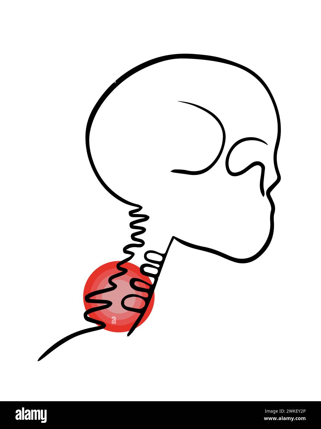 Illustration vectorielle isolée de douleurs des vertèbres cervicales. Tracé du contour de la ...