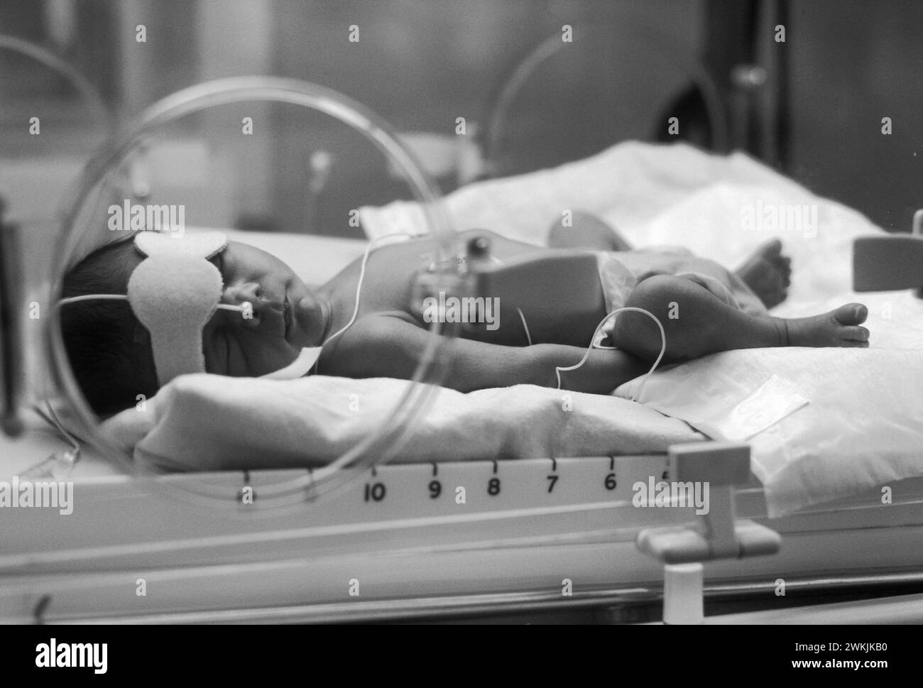 Prem premature baby Banque d'images noir et blanc - Alamy