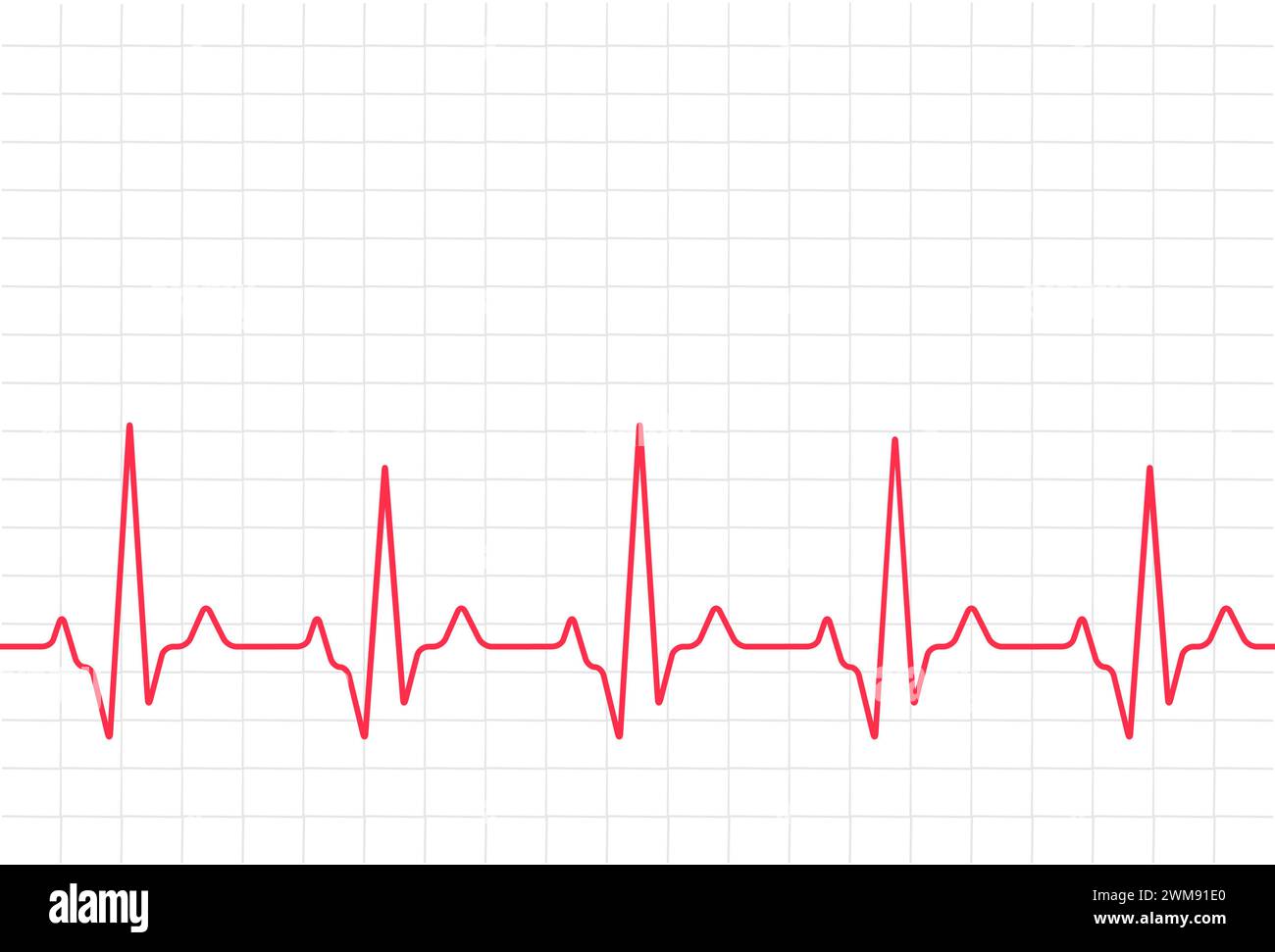 Moniteur de battements cardiaques ECG, onde linéaire de pouls cardiaque ...