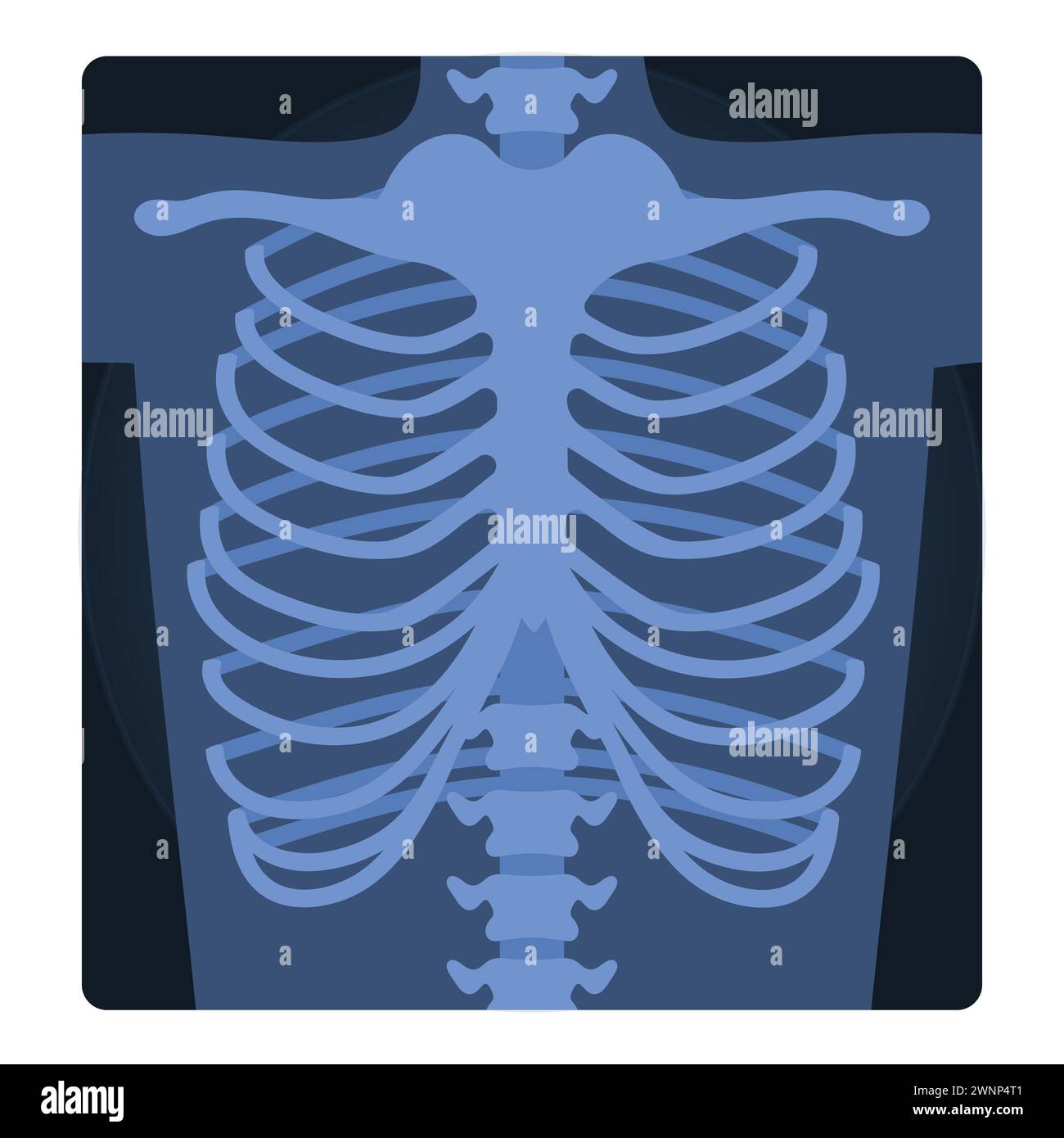 Radiographie médicale du thorax humain. Test médical du squelette ...