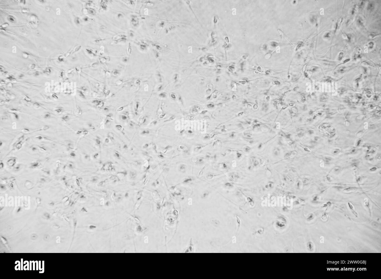 Sperm cells microscope Banque d'images noir et blanc - Alamy