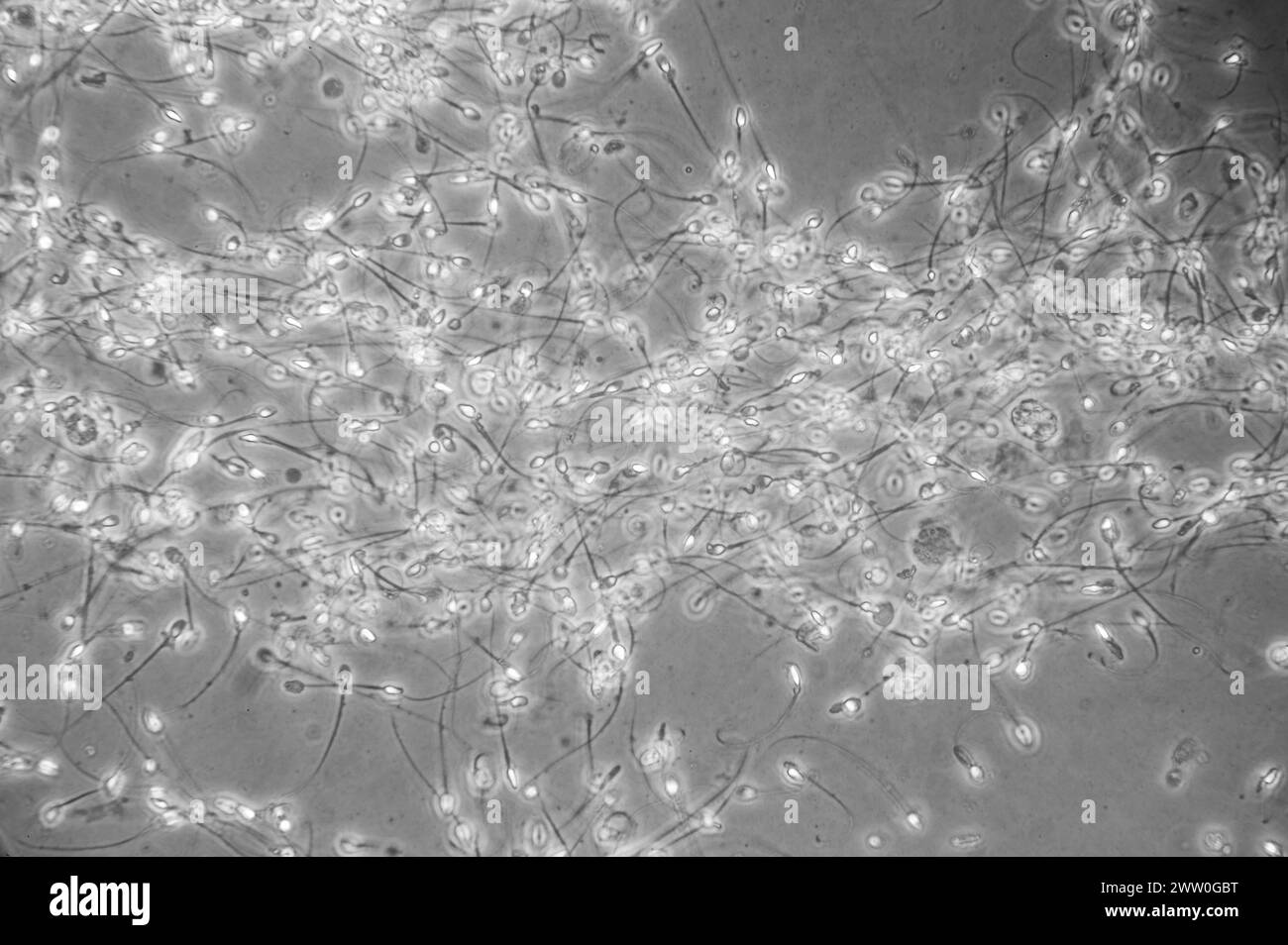 Sperm cells microscope Banque d'images noir et blanc - Alamy