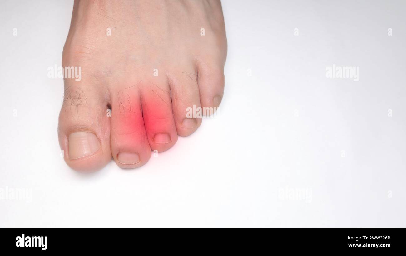Anatomie pied gauche Banque de photographies et d’images à haute ...