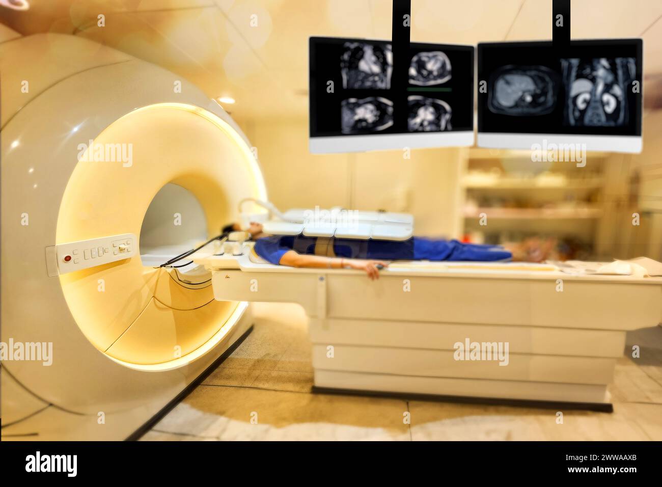 Irm du haut de l'abdomen Banque de photographies et d’images à haute ...