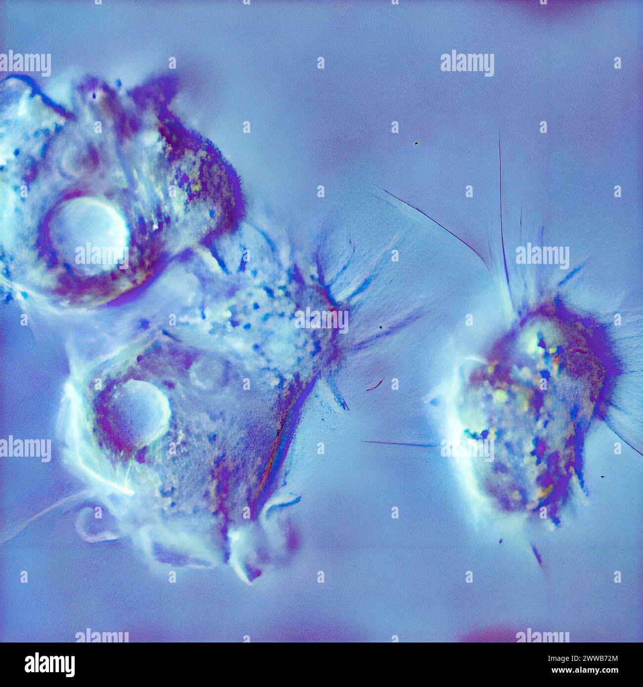L'Acanthamoeba est une amibe microscopique, libre-vivant, ou amibe ...
