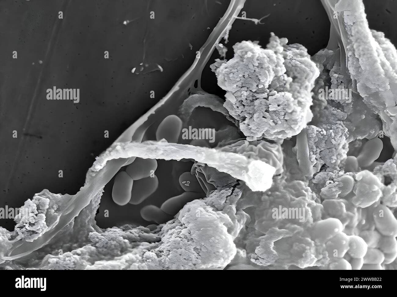 Imagerie microscopique Banque de photographies et d’images à haute ...