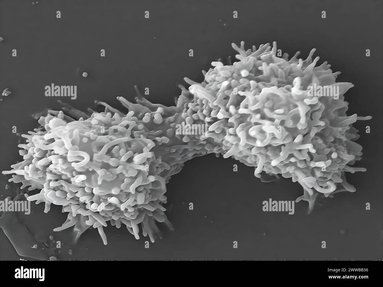 Cette image au microscope électronique à balayage (MEB) a révélé un ...