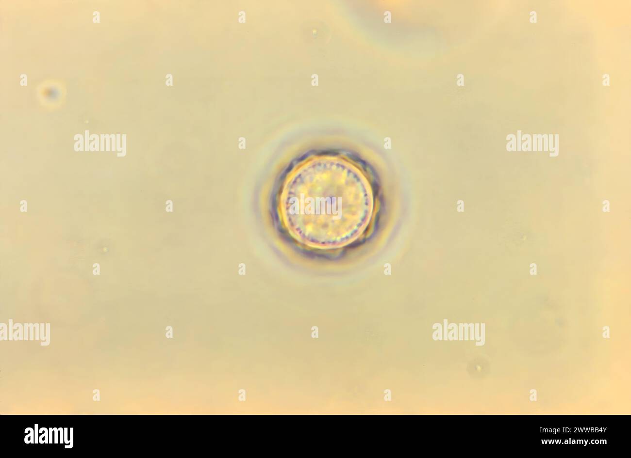 Cette photomicrographie vous montre une partie de la morphologie ...